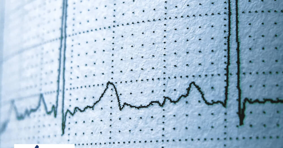 Lectura rápida del ECG en Atención Primaria | Cátedra USC-Semergen